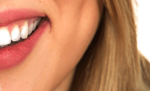 Meet Our Team At Friars Walk - Friars Walk Dentist